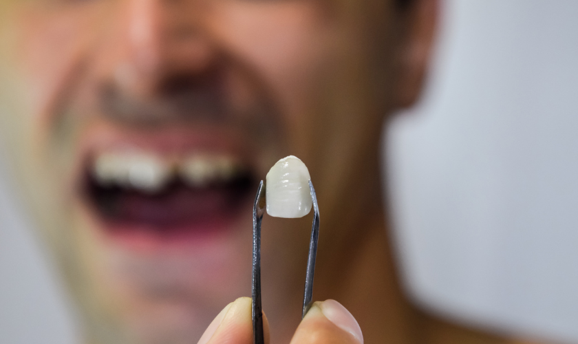 The Importance Of Replacing Your Lost Tooth: Don't Ignore It!